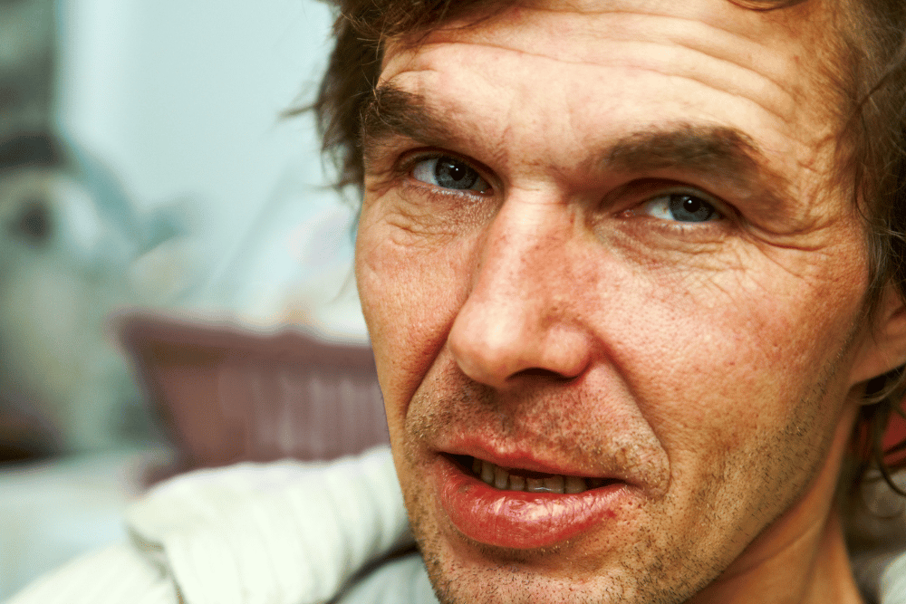 How to Spot an Alcoholic Face: 6 Crucial Signs | Avenues Recovery