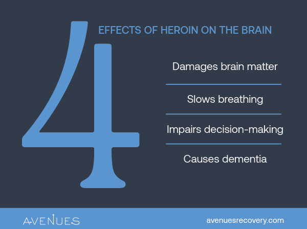 How Does Heroin Affect the Brain? | Avenues Recovery