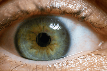 Eyes on Drugs: How to Spot the Signs | Avenues Recovery