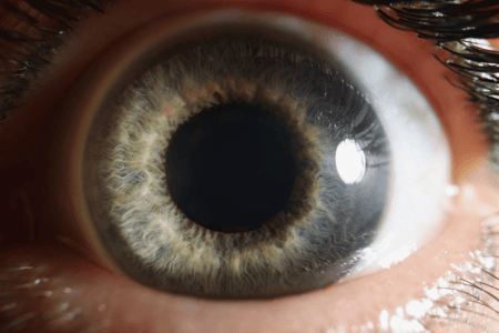 Eyes on Drugs: How to Spot the Signs | Avenues Recovery