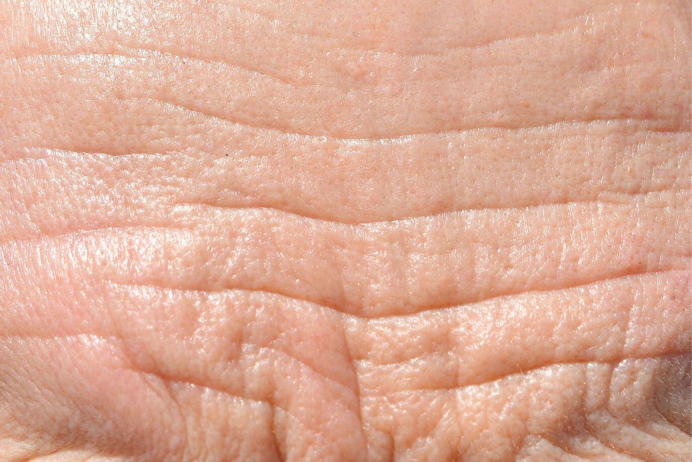 How to Spot an Alcoholic Face: 6 Crucial Signs | Avenues Recovery