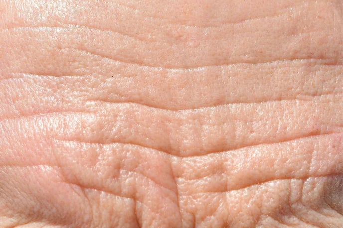 How to Spot an Alcoholic Face: 6 Crucial Signs | Avenues Recovery